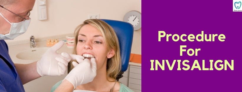 Best Dental Clinic for Invisalign in Bellandur | Nelivigi Dental Clinic